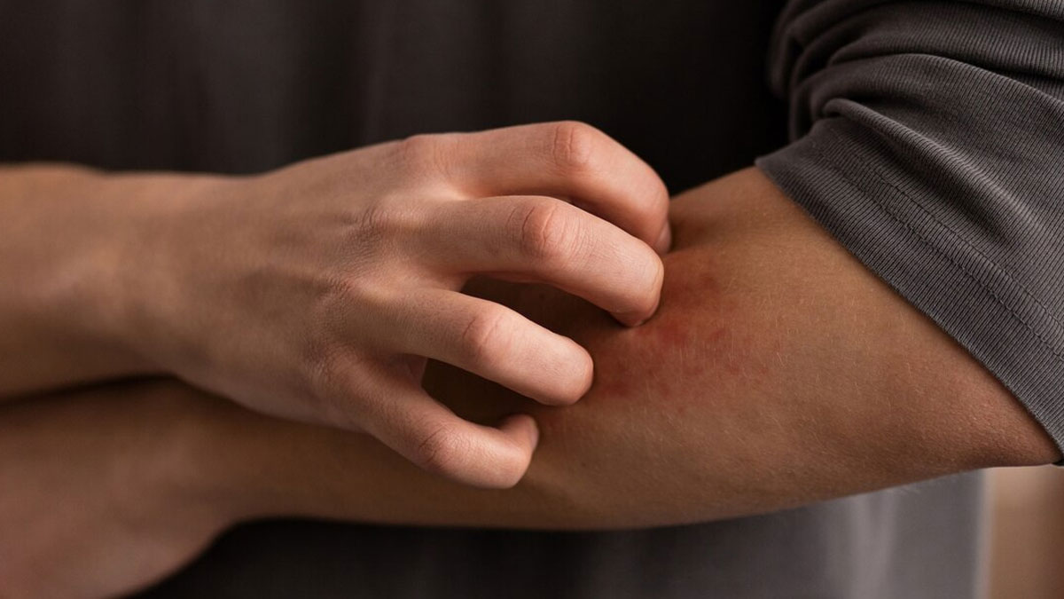 Skin Allergies! - Pradhanclinic