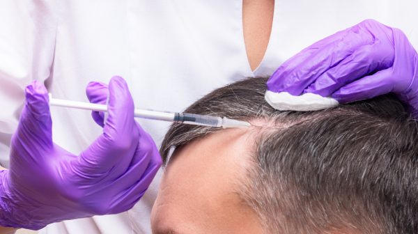 PRP Therapy in Faridabad | Hair Fall & Skin Rejuvenation Treatment